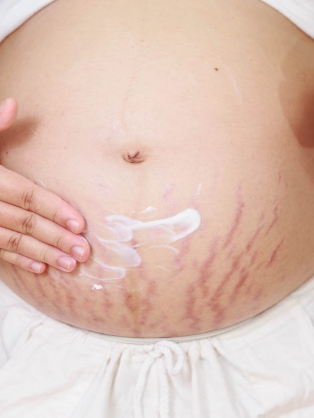 Dicas Para Evitar Estrias Durante A Gravidez Blog Panorama Móveis